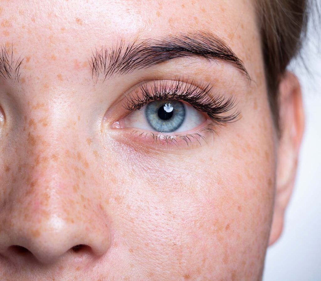 Ophthalmologist Austin | Eye Disorders Austin | Westlake Eye