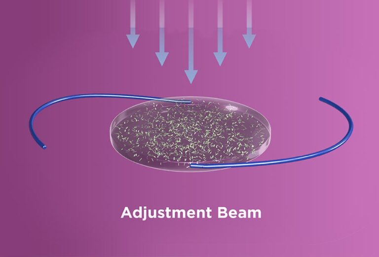 Light Adjustable Lens | Westlake Eye Specialists