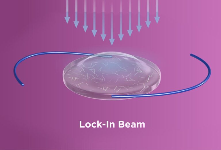 Light Adjustable Lens | Westlake Eye Specialists