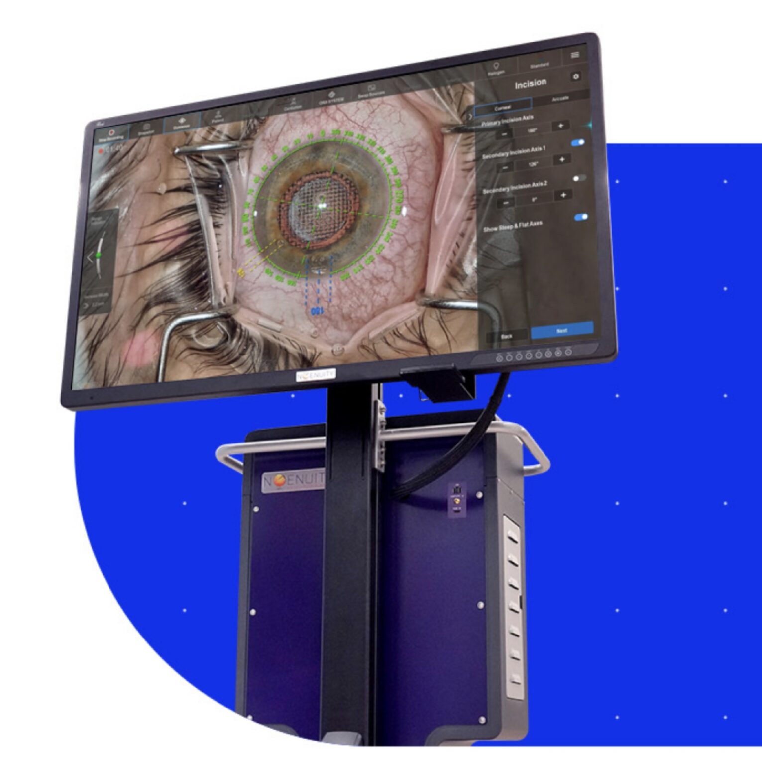 NGenuity 3D Cataract Surgery in Austin, TX | Westlake Eye Specialists