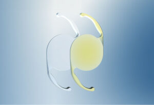 Alcon Clareon Toric Lens for Astigmatism | Austin Cataract Surgeon ...